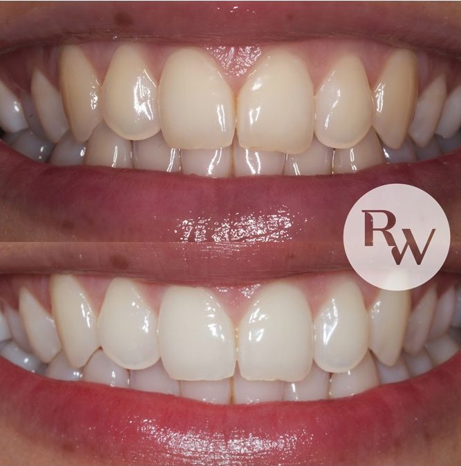 Maintenance - RW Perio